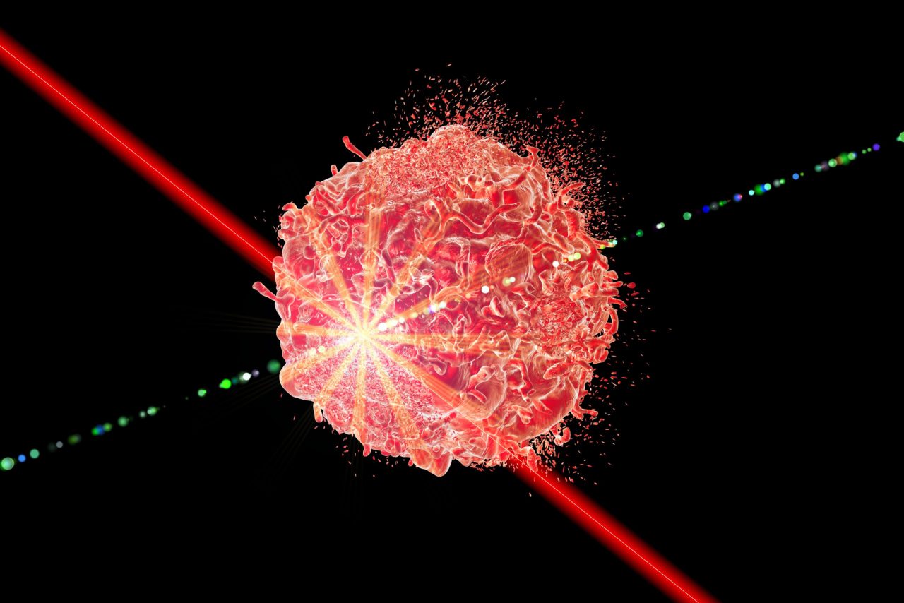 What are the different types of radiotherapy? - Tests to predict ...